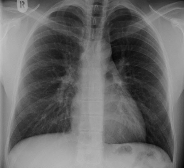 Röntgenfoto's - Alrijne Ziekenhuis