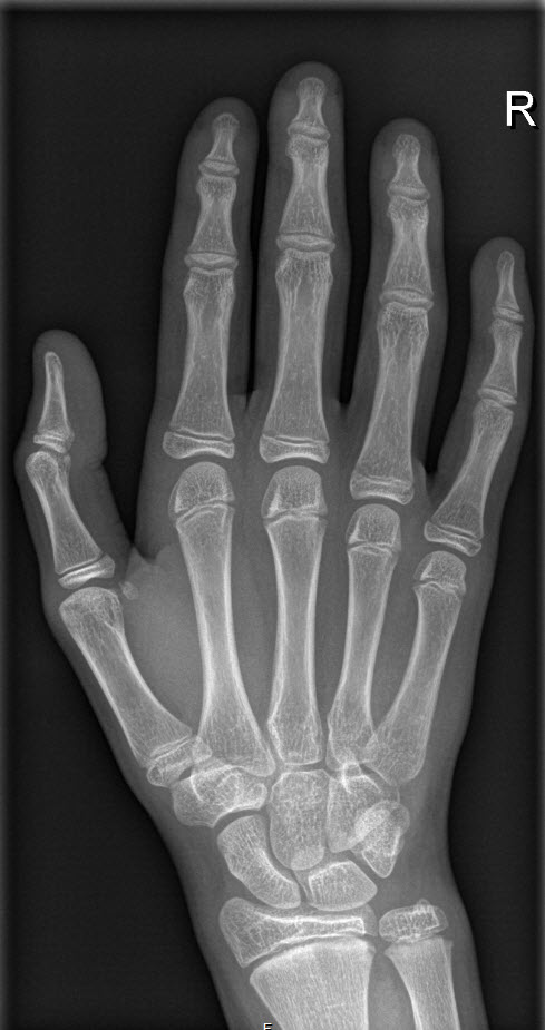 Rontgenstraling - Alrijne Ziekenhuis